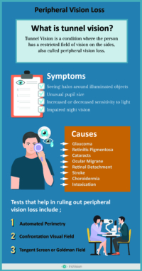 Peripheral Vision Loss - Getting Acquainted with the Basics | Irisvision